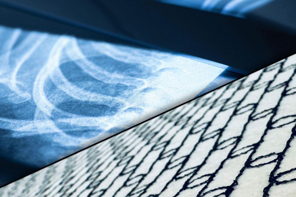 Embro's X-ray transparent patient warming systems